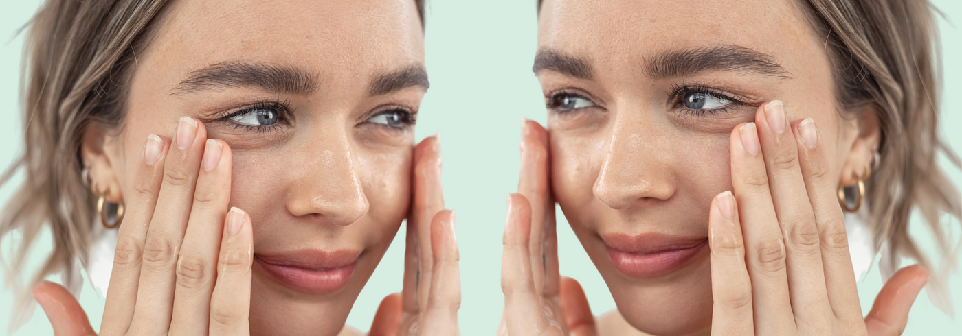 How To Fade Pigmentation At Home